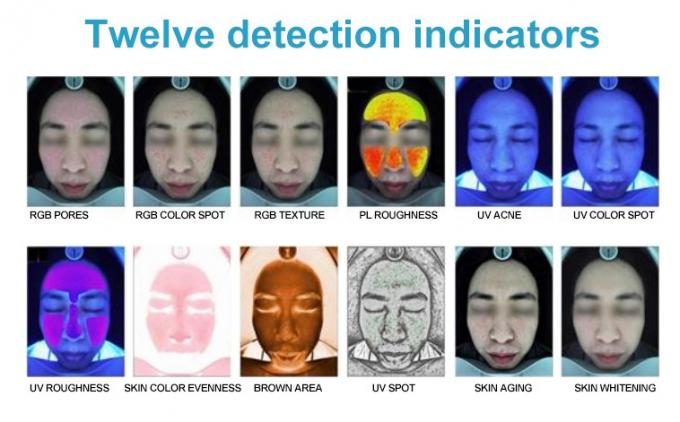 Skin Analysis Machine doctor use skin problems detect CE FCC 2years wty
